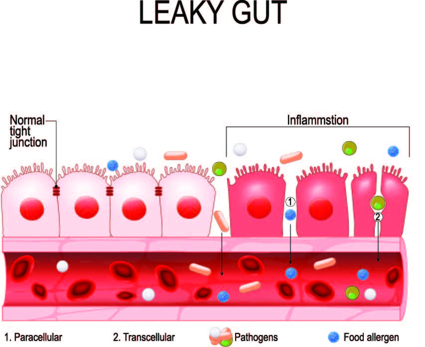 Gut Health and the Microbiome: Men's Guide to Optimization